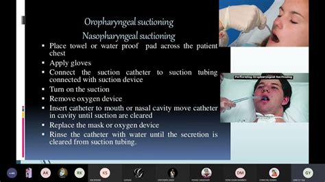 Dental Suctioning Procedure At Hunter Berry Blog