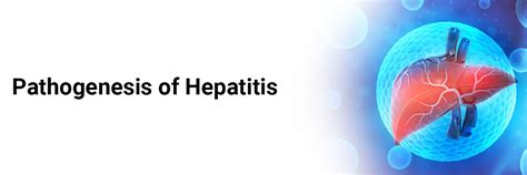 Pathogenesis Of Hepatitis How It Develops And Its Different Types