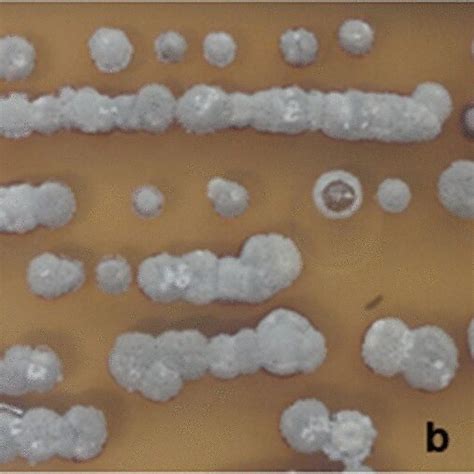 Morphological Characteristics Of Streptomyces Sp Isolates A Spore Download Scientific Diagram