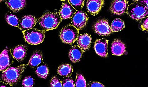 Normal Human Bronchial Epithelial Cells Mattek Part Of Sartorius