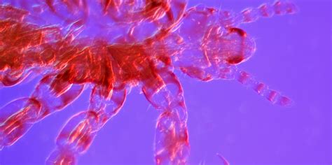 Body Lice Skin