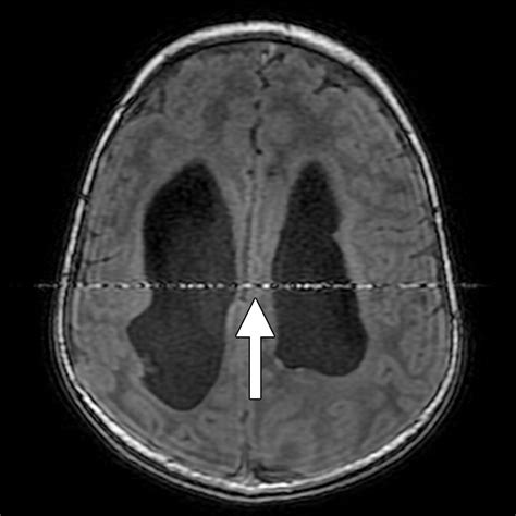 Mr Imaging Artifacts And Parallel Imaging Techniques With Calibration