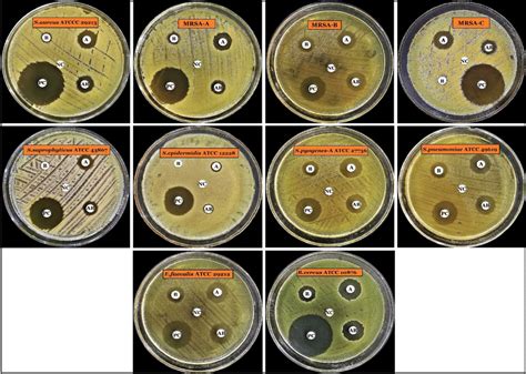 Primary Antimicrobial Activity Of Isolated Actinomycins X2 And D