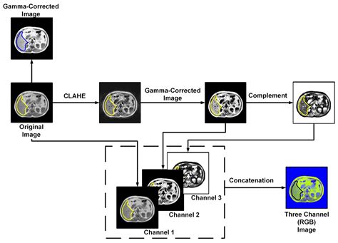 Deep Learning Framework For Liver Segmentation From T1 Weighted Mri Images