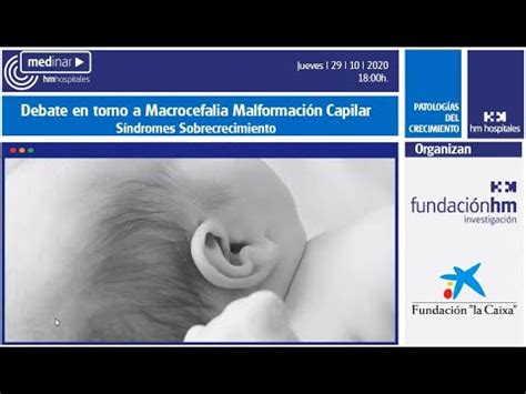 Diagnóstico Y Tratamiento De La Macrocefalia Enfoque Integral Para