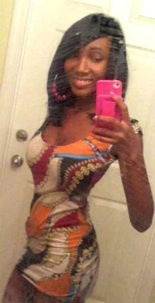 Plastic Surgery Isnt Always Good For You 12 Pics Izispicy Com