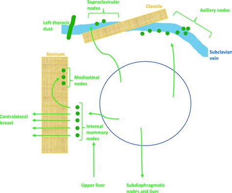 Bras Lymph Nodes Breast Cancer At Madalyn Hartley Blog