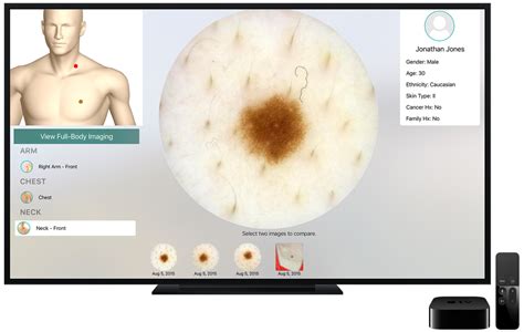 Dermengine The Most Intelligent Dermatology Platform