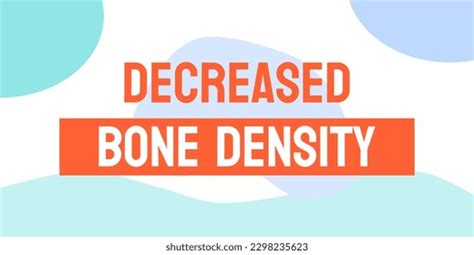 Decreased Bone Density Loss Bone Mass Stock Vector Royalty Free