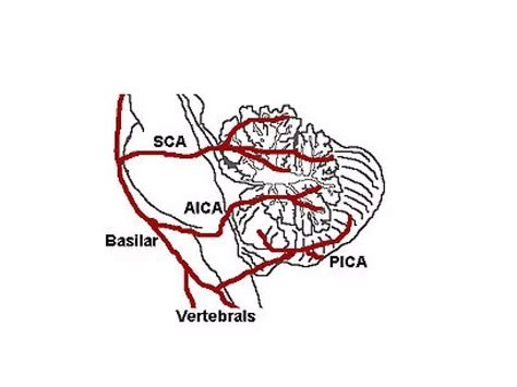 Stroke Syndrome 2pdf