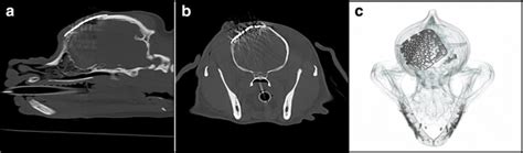 Understanding Calvarial Defect Causes And Treatment Options