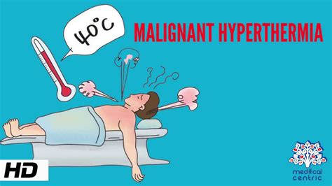 Malignant Hyperthermia Poster