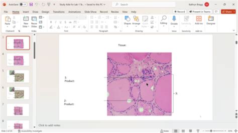 Anatomy 2 Lab Practical 1 Flashcards Quizlet