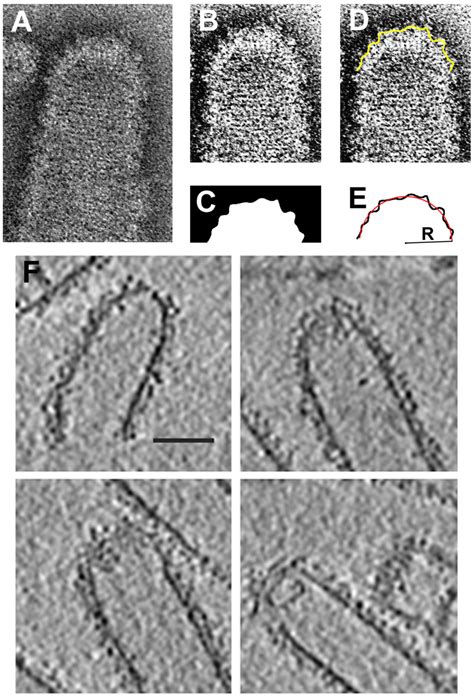 Imaging Of The Escrt Iii Chmp2a Chmp3 Assembly A Electron Download Scientific Diagram