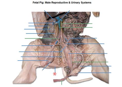 Bio 211 Lab Quiz 4 Urinary And Reproductive System Set 4