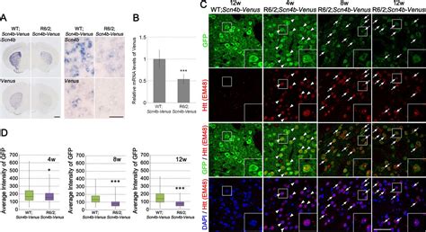 facs array based cell purification yields a specific transcriptome of striatal medium spiny