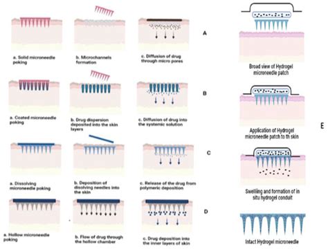 Improved Topical Drug Delivery Role Of Permeation Enhancers And