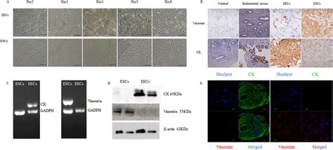 Identification Of Human Endometrial Epithelial Cells And Stromal Cells