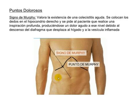 Dolor Abdominal Medicina Interna Ii Uai
