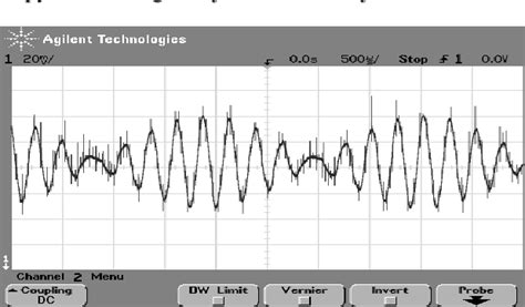 Figure 1 From Integrated Ultrasonicinterferential Current System For