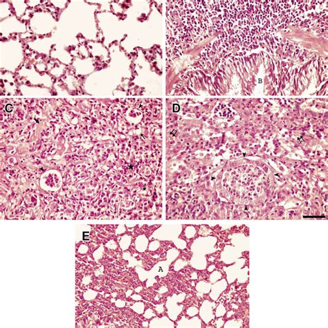 E Light Microscopy Of Lung Tissues In Different Groups Hematoxylin And