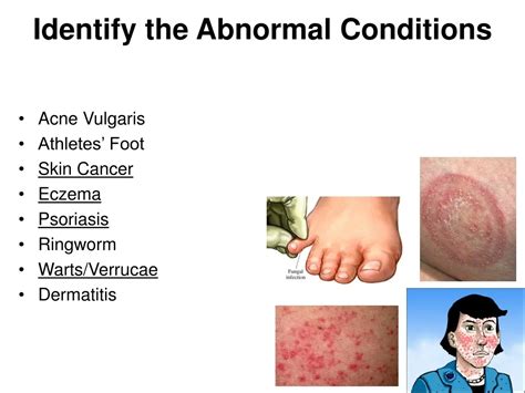 Ppt Skin Abnormalities Colors Eruptions And Diseases Powerpoint