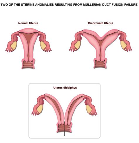 Meet The Woman That Has 2 Vaginas Others