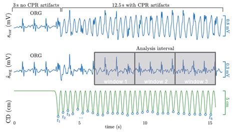 Rhythm Analysis During Cardiopulmonary Resuscitation Using Convolutional Neural Networks