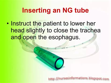 Nasogastric Tube Ngt Insertion And Removal Pps