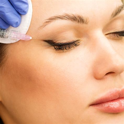 What Are The 3 Main Areas For Botox