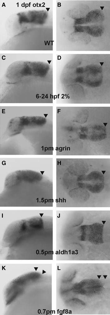 Caudally Expanded Expression Of Otx2 Mrna Only Occurs In Fgf8a