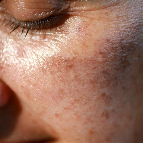 Louis Widmer Home Louis Widmer