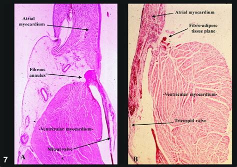 Anatomy Of The Human Atrioventricular Junctions Revisited Anderson