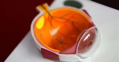 Delayed Diagnosis Of Congenital Optic Disc Abnormalities May Worsen