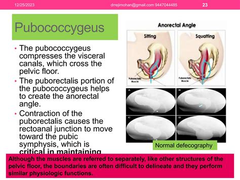 Pelvic Floor Anatomy And Repairpptx For Teaching Pptx