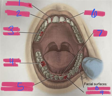 Tooth Surfaces Diagram Flashcards Quizlet