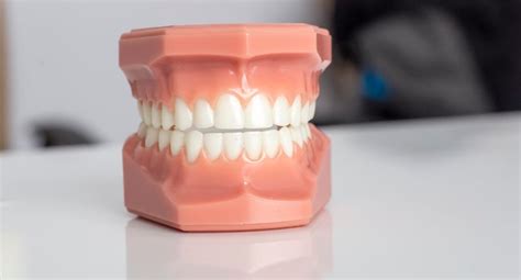 Liežuvio Grybelis Pgdent