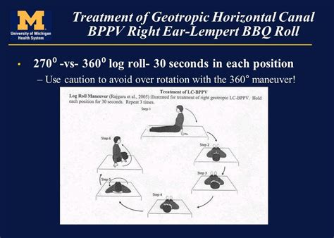 6 Pics Barbecue Roll Horizontal Bppv And Description Alqu Blog