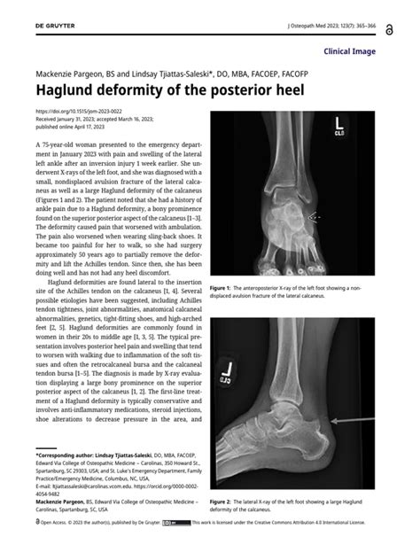 Haglund Deformity Of The Posterior Heel Pdf Foot Musculoskeletal System