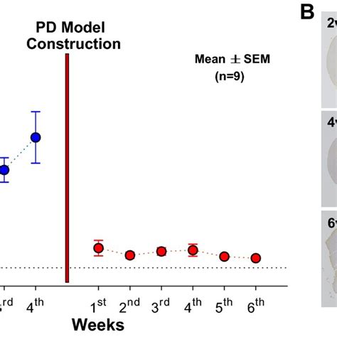 Loss Of Th⁺ Neurons In Medial Forebrain Bundle Mfb After The