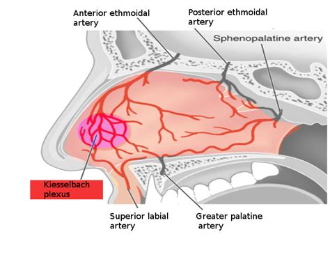 Anterior Epistaxis Nasal Pack Treatment And Management Point Of Care