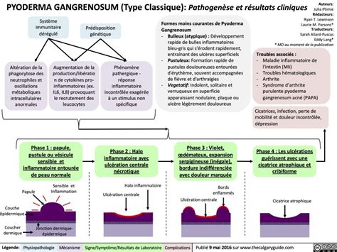 Pyoderma Gangrenosum Type Classique Pathogenèse Et Résultats Cliniques Calgary Guide
