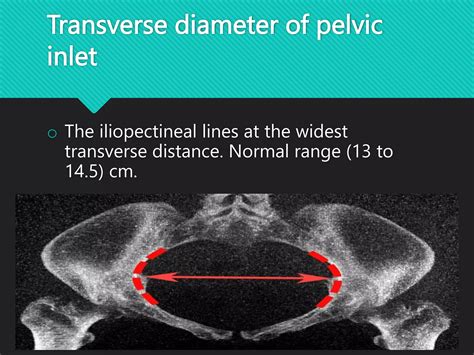 Pelvimetrypptx