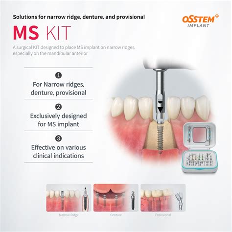Osstem Thailand Osstem Ms Kit