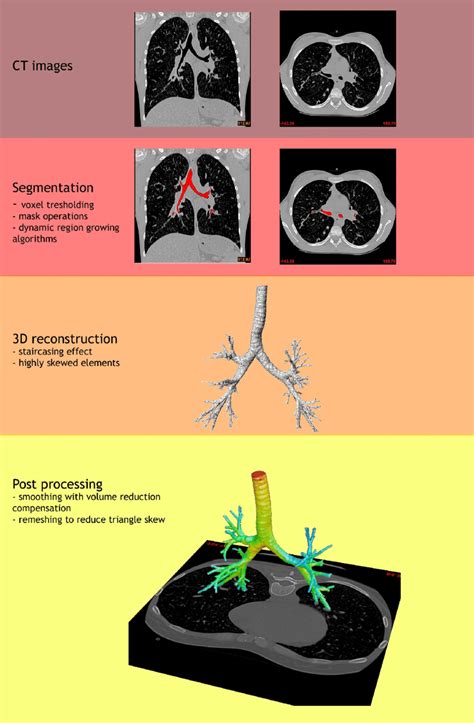 segmentation workflow of airway model using mimics download