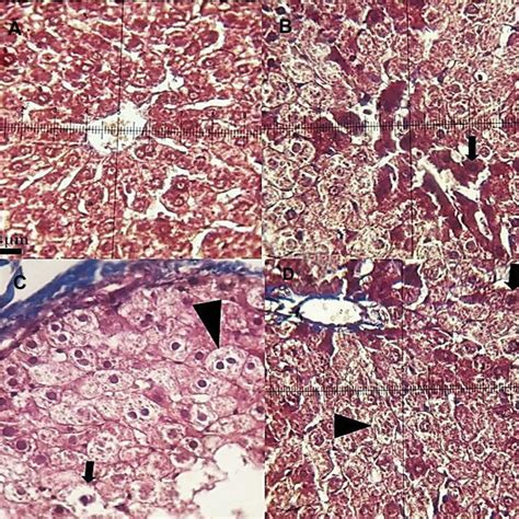 A Periodic Acidschiff Pas Staining Of A Liver Section Download