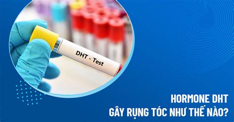 Hormone DHT gây rụng tóc như thế nào Làm sao để giảm tác hại