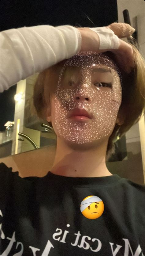 Khhfess Giveaway Bulanan Pinned 📌 On Twitter Khh Adek Kenapa Bisa Tangannya Pake Perban