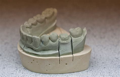 Dental Lab Model Fabrication Making Noise And Drinking Beer