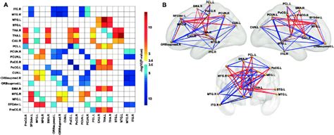 The Pattern Of Altered Functional Connectivity A The Functional Download Scientific Diagram